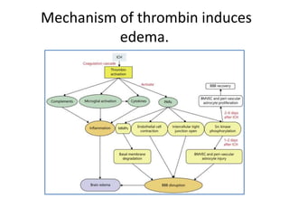ICP 2o Traumatic ICH vs contusion ( TBI).pptx