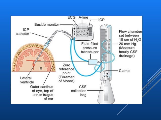 ICP Assessment -Divya CT.pptx cfgjkkkkkkk | PPT