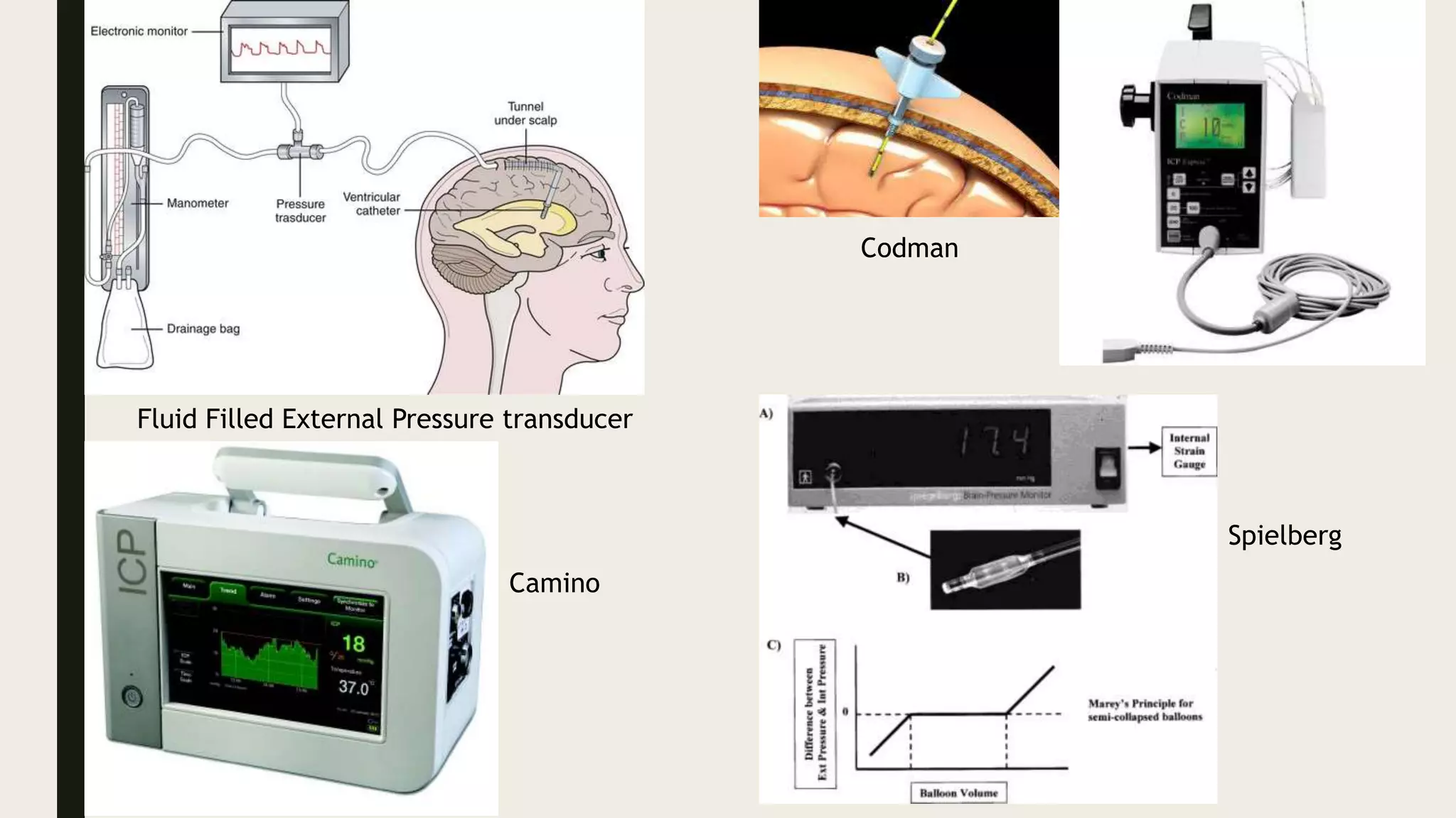 ICP control and CSF drainage - Final.pptx | Death, Injury, or Military ...