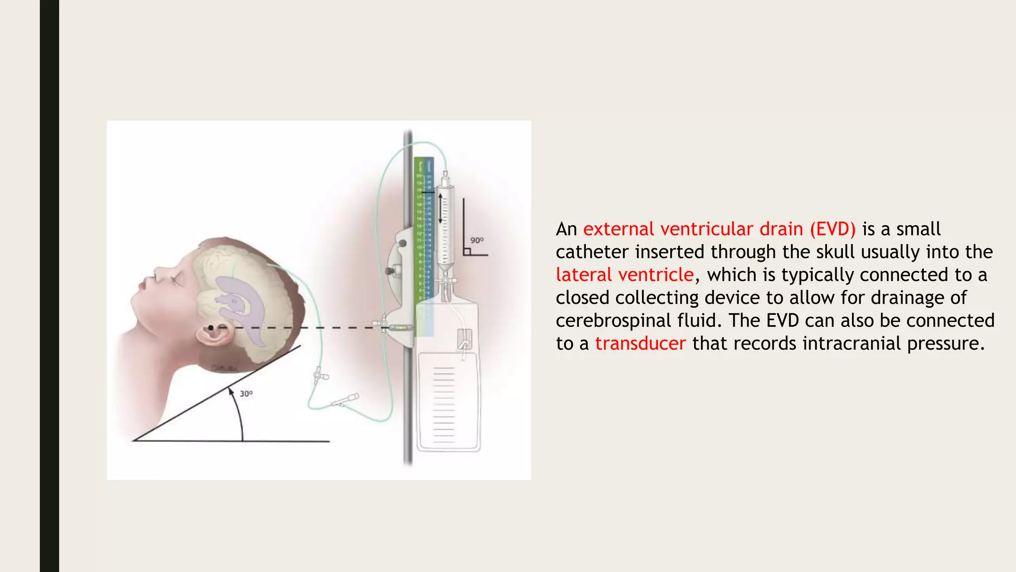 ICP control and CSF drainage - Final.pptx | Death, Injury, or Military ...