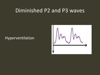 Icp monitoring &brainherniation | PPTX