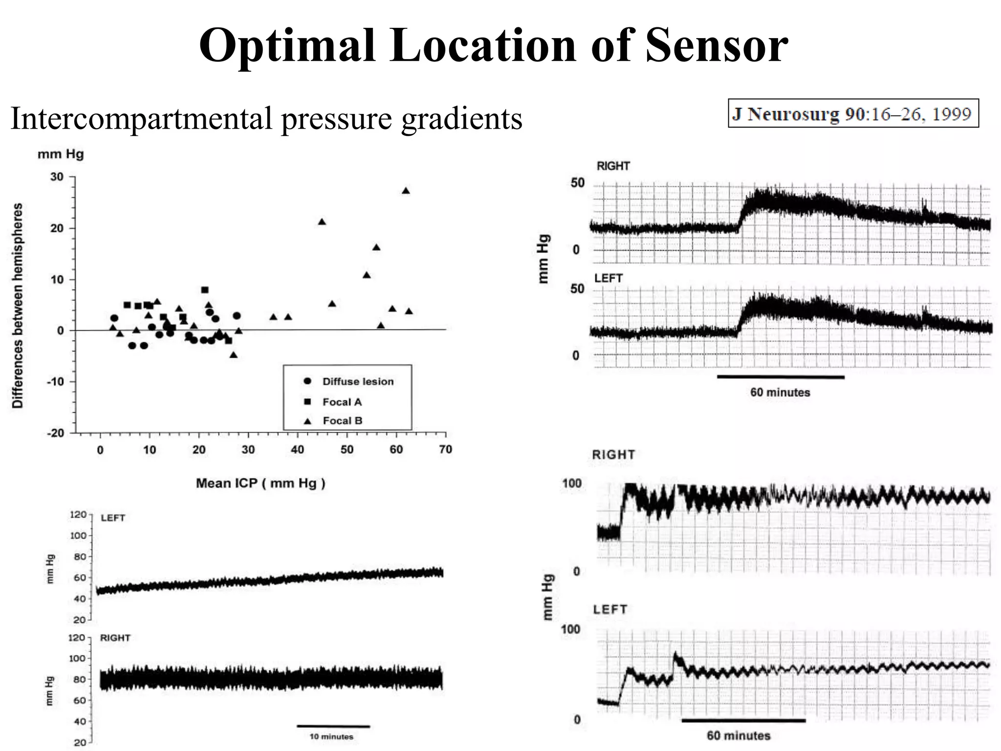 Icp monitoring seminar | PPTX