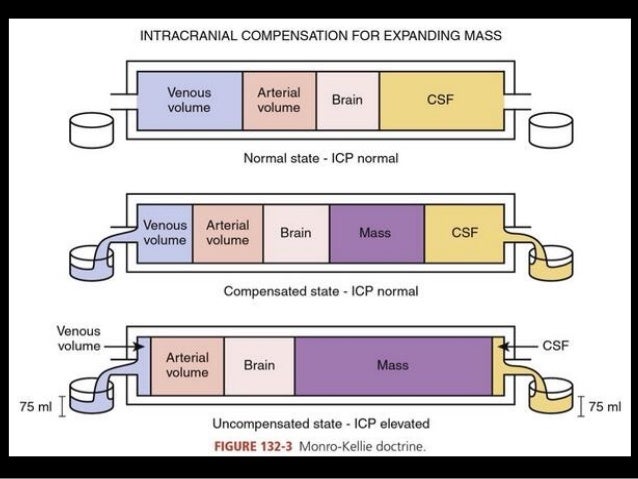 ICP Management in Severe TBI