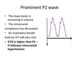 intracranial pressure monitoring | PPTX