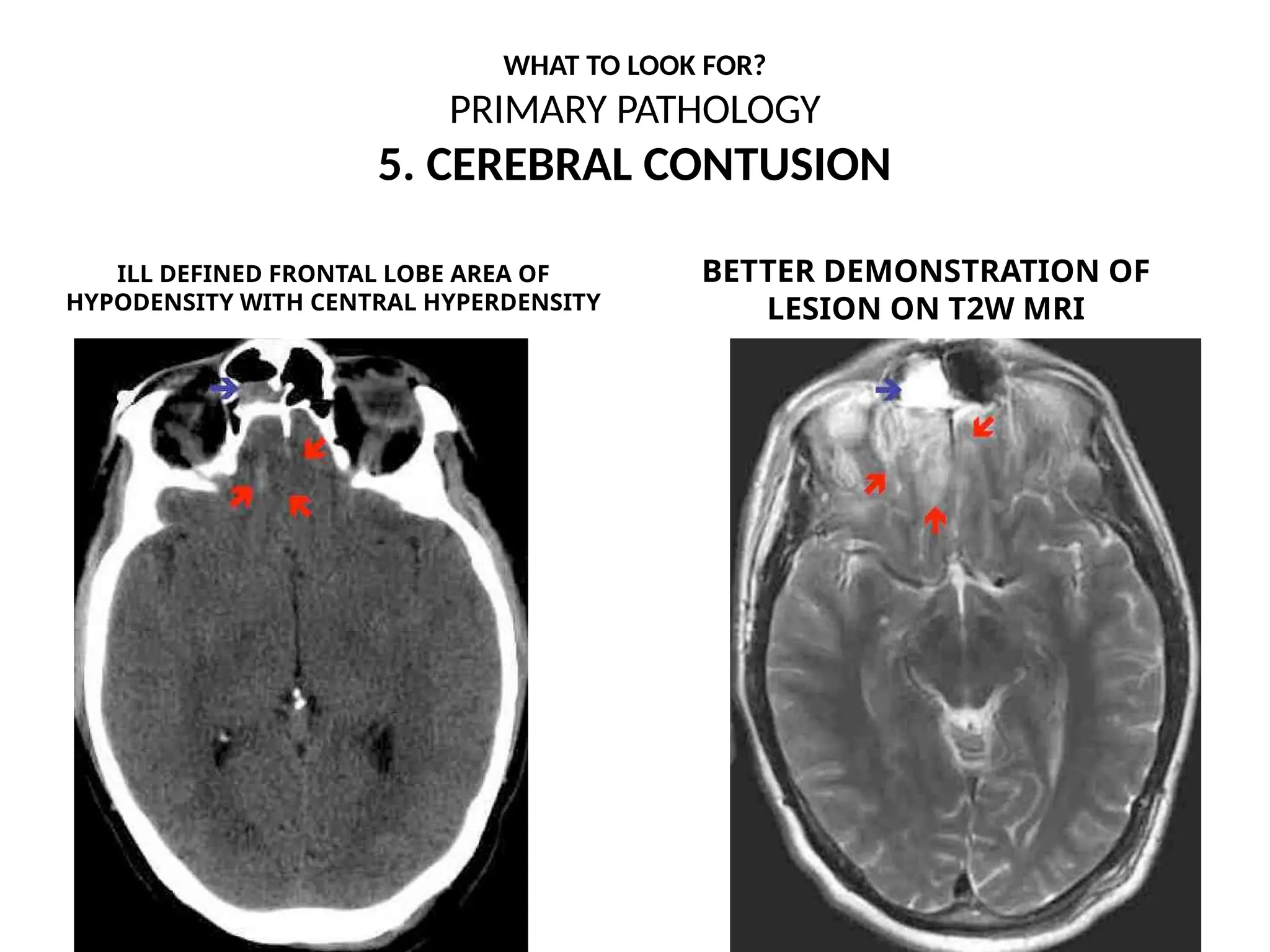 Interventional radiography Angiography p | PPT