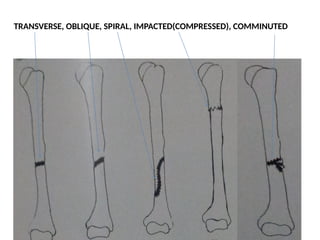 Interventional radiography Angiography p | PPTX