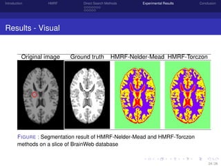 Hidden Markov Random Fields and Direct Search Methods for Medical Image Segmentation | PDF