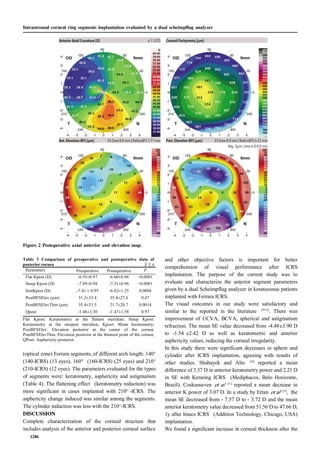 A Tomografia e o Implante de Anel de Ferrara | PDF