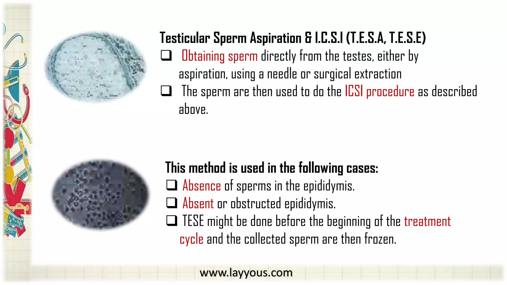 Intracytoplasmic Sperm Injection - ICSI | PPTX
