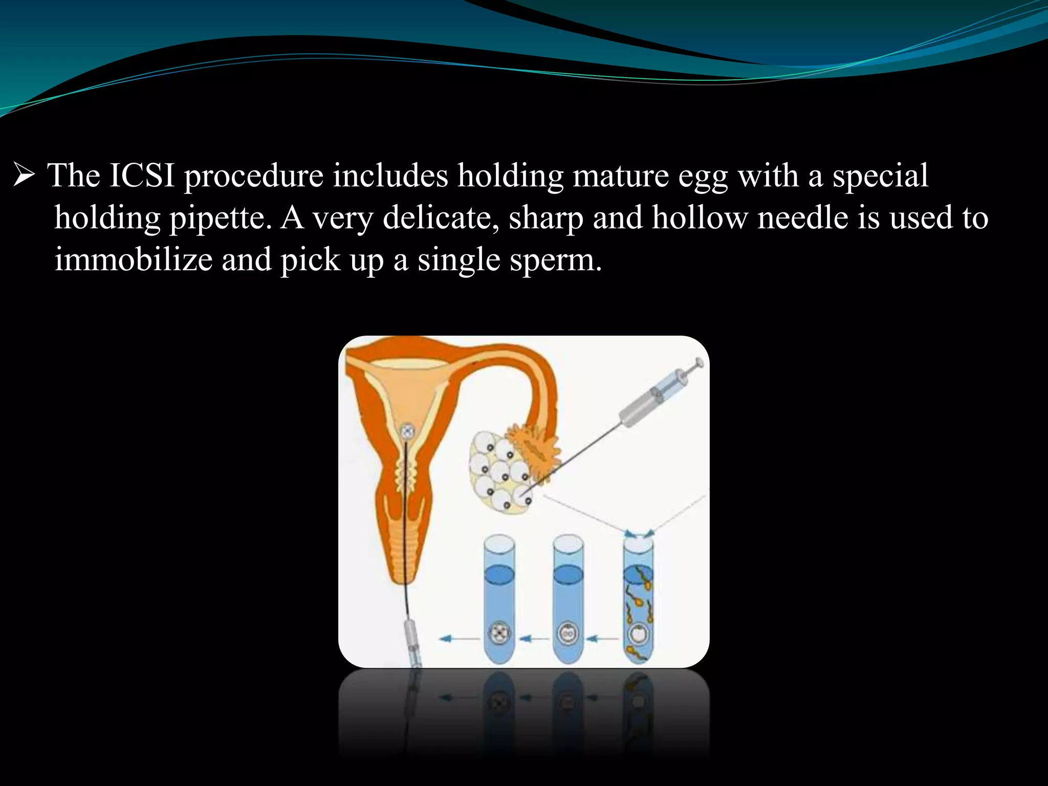 Icsi treatment | PPT