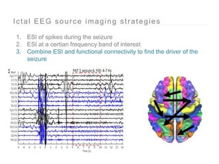 Ictal EEG source imaging | PPT