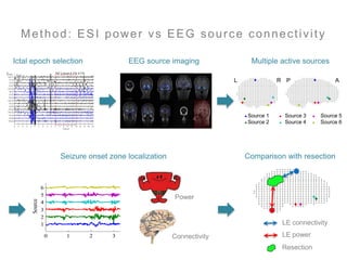 Ictal EEG source imaging | PPT