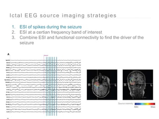 Ictal EEG source imaging | PPTX | Brain and Nervous System Disorders | Diseases and Conditions