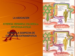 Ictericia | PPT