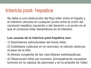 Ictericia | PPTX