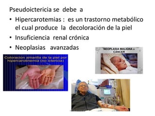 Ictericia | PPTX