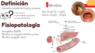 ICTERICIA.pdf