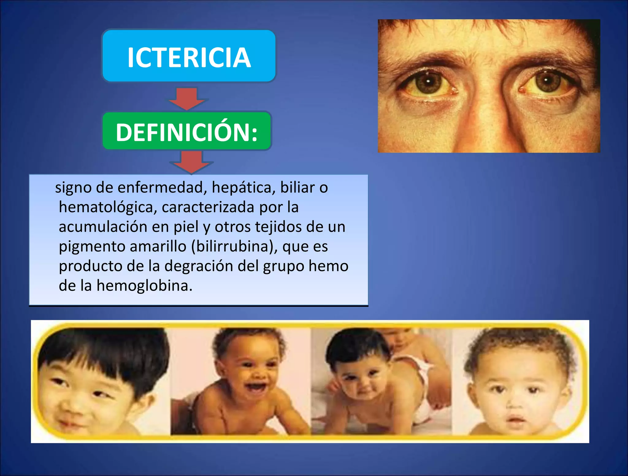 Ictericia expo | PPT