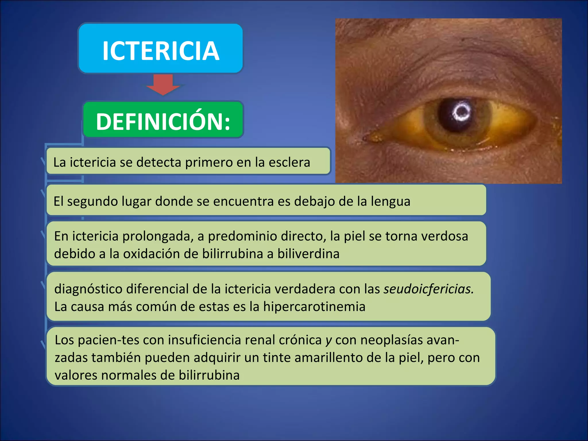 Semiologia: Ictericia | PPT