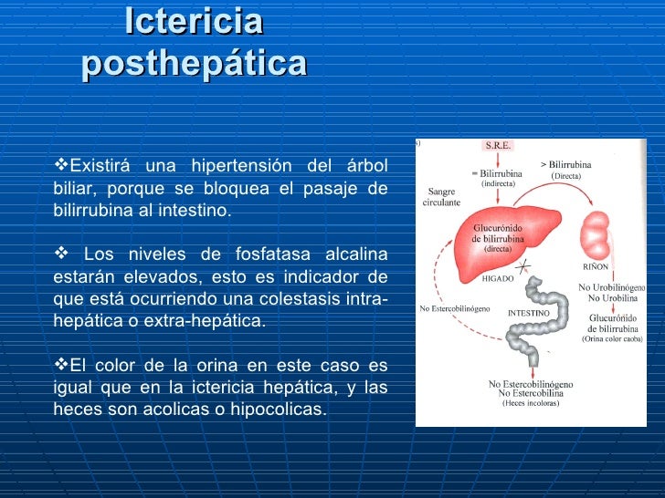 Fisiopatologia: Ictericia