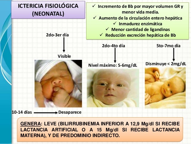 Ictericia y lactancia materna: medlineplus enciclopedia médica