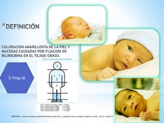 Ictericia neonatal | PPTX