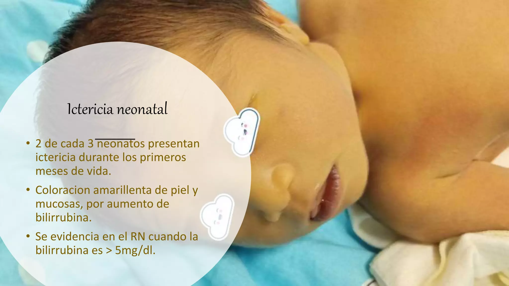 Ictericia neonatal | PPTX