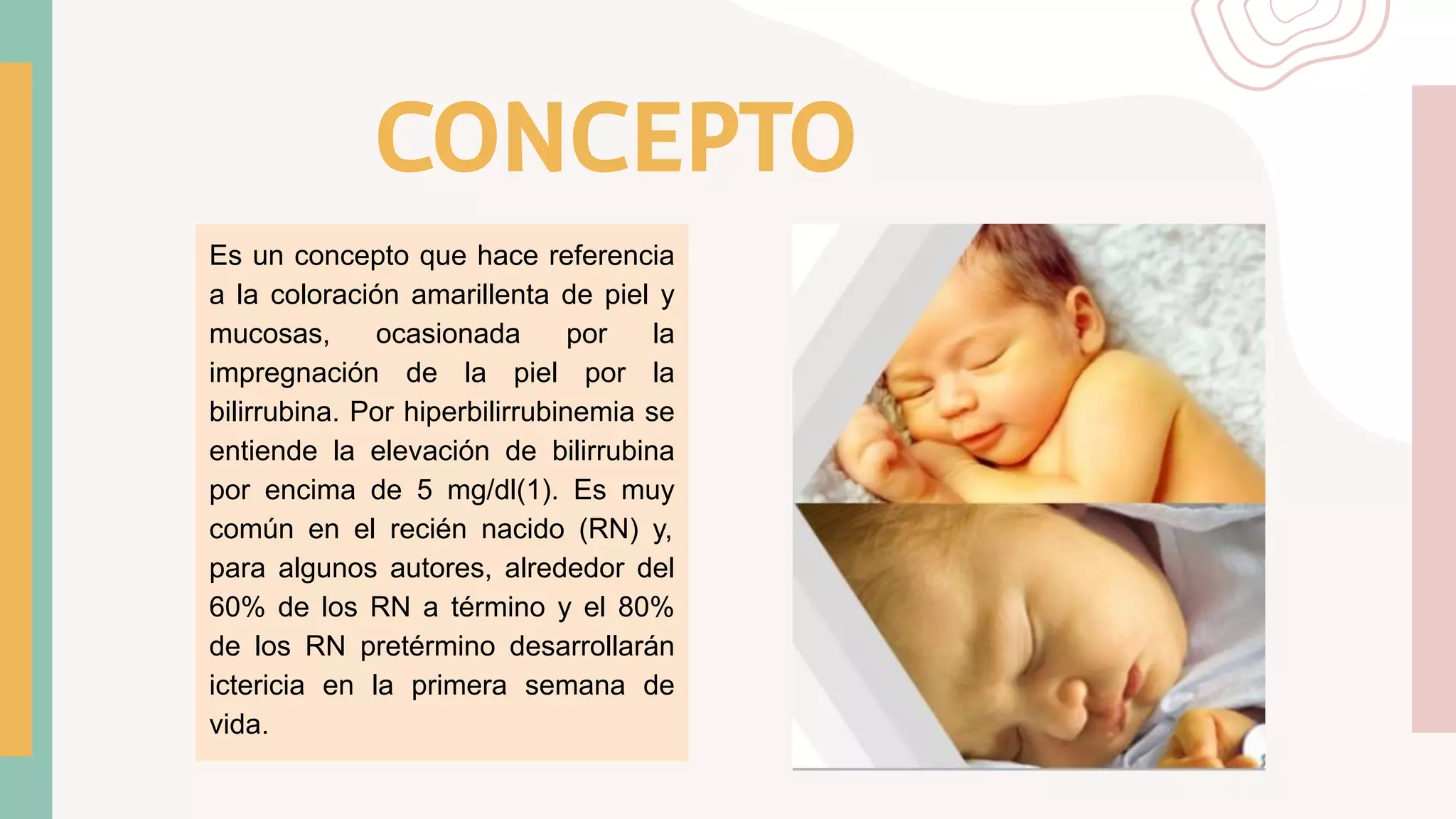 ictericia neonatal.pptx (1).pdf