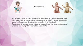 Ictericia neonatal_tratamiento_diagnostico.pptx