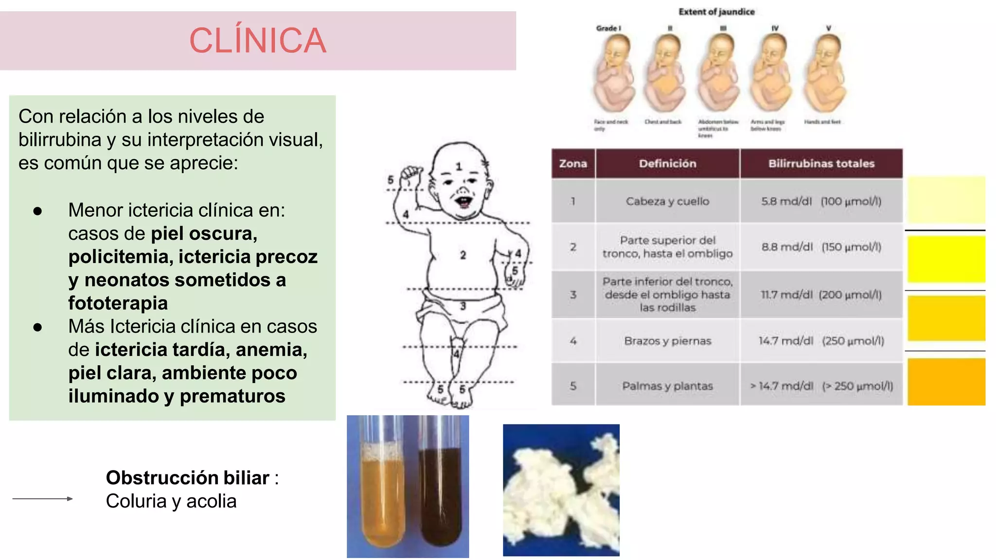 ICTERICIA NEONATAL - DIAPOS (1).pptx