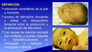 ICTERICIA_NEONATAL EN pediatria2.0[1].pptx