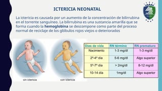 ICTERICIA_NEONATAL Enfermeria pediatrica | PPTX