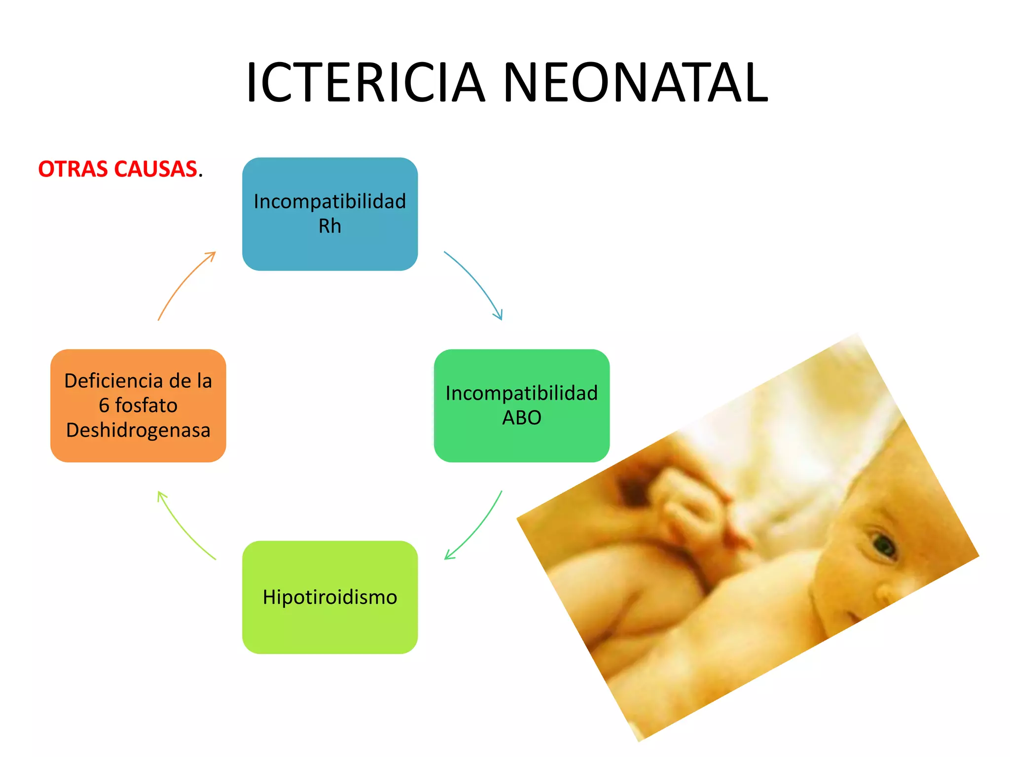 Ictericia Neonatal Jueves 2015 Ppt