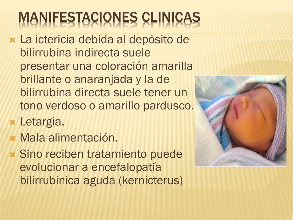 Síntomas: Ictericia – Que Es La Ictericia – JYNFLT