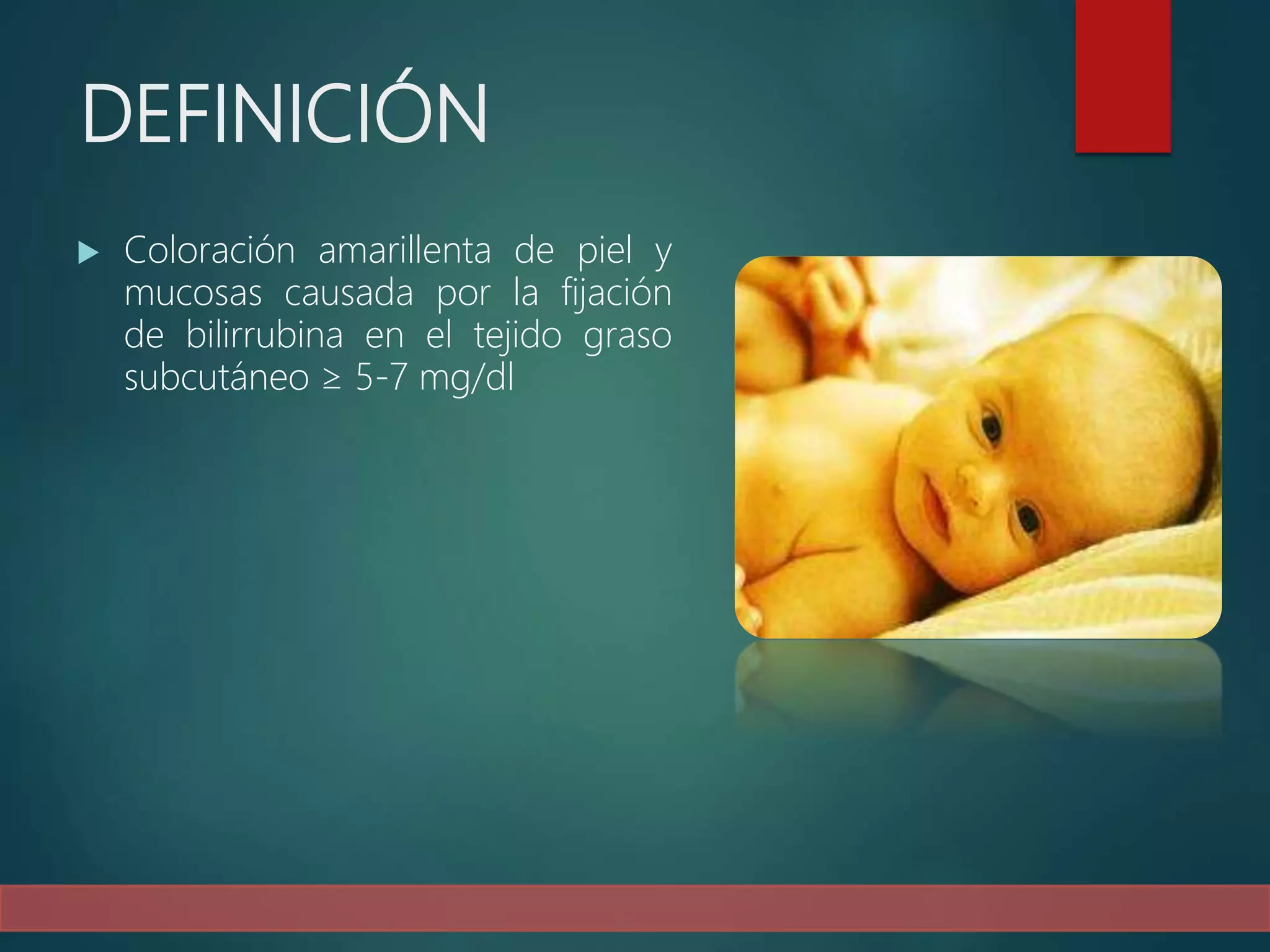 Ictericia Neonatal X Ppt