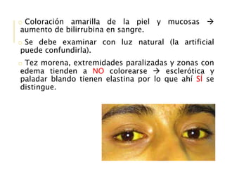 Ictericia | PPTX