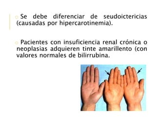 Ictericia | PPTX