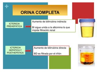Ictericia ssg | PPTX