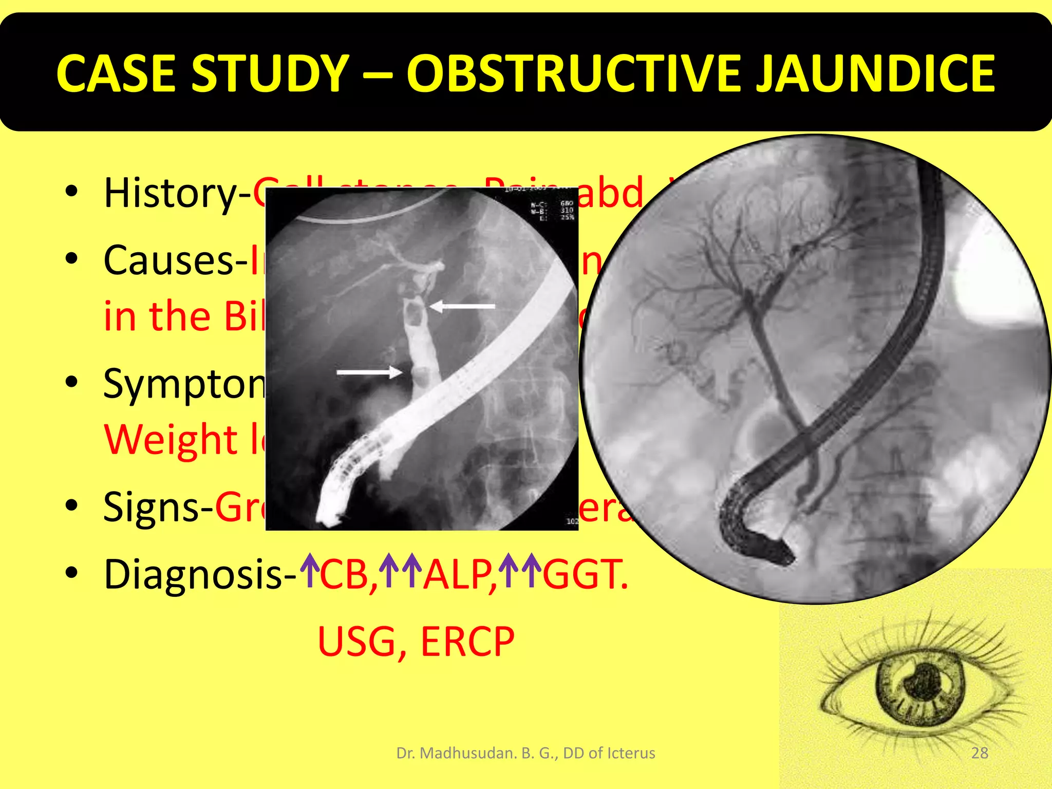 Differential Diagnosis of Icterus/Jaundice | PPTX