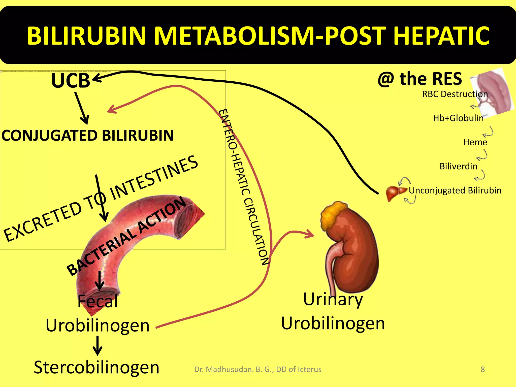 Differential Diagnosis of Icterus/Jaundice | PPTX