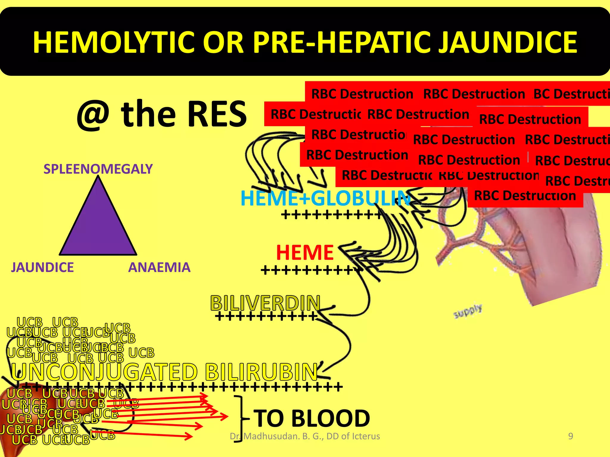 Differential Diagnosis of Icterus/Jaundice | PPTX