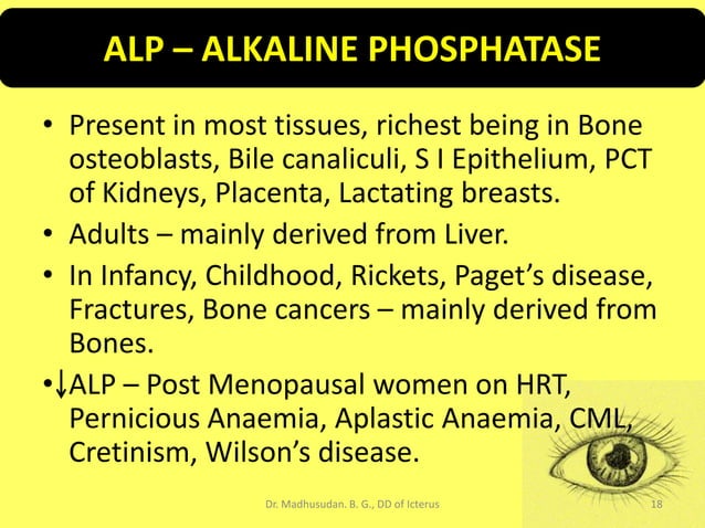 Differential Diagnosis of Icterus/Jaundice | PPTX | Blood Disorders ...