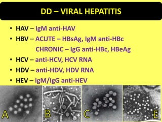 Differential Diagnosis of Icterus/Jaundice | PPTX