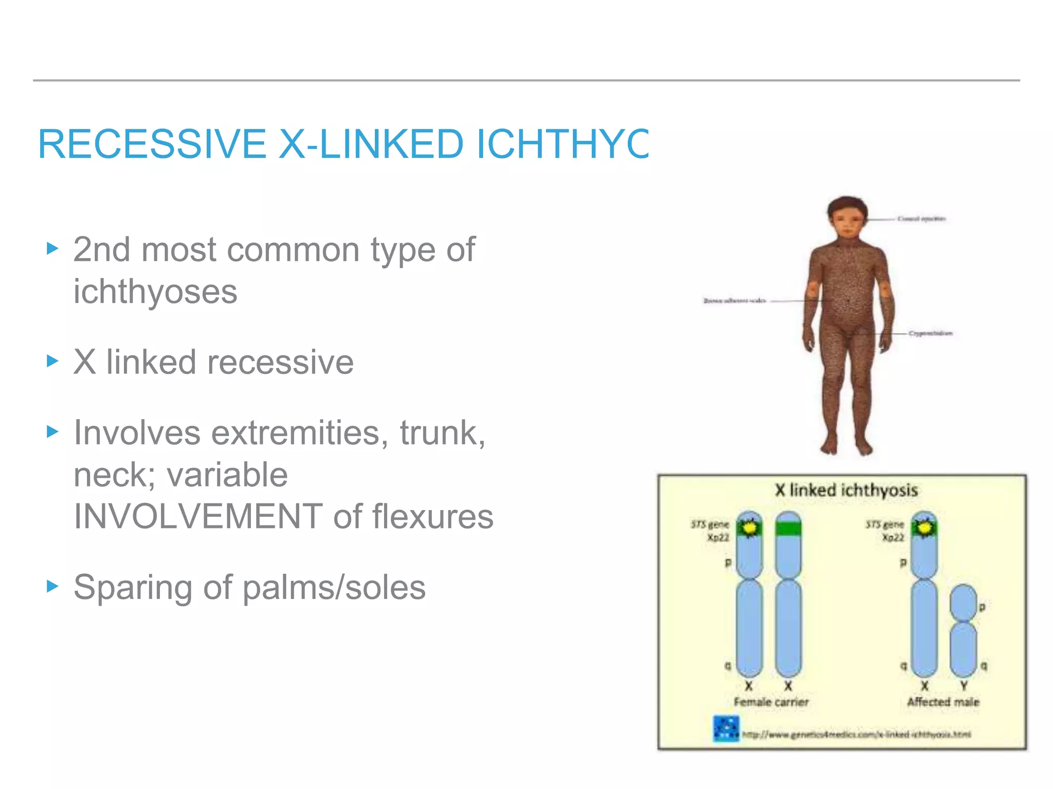 Icthyosis | PPTX