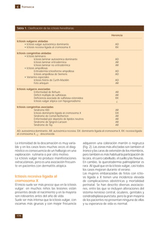 Ictiosis | PDF