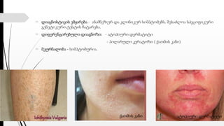 Ichthyosis | PPTX