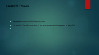 ICU - The ECG - ELECTROCARDIOGRAM.pptx