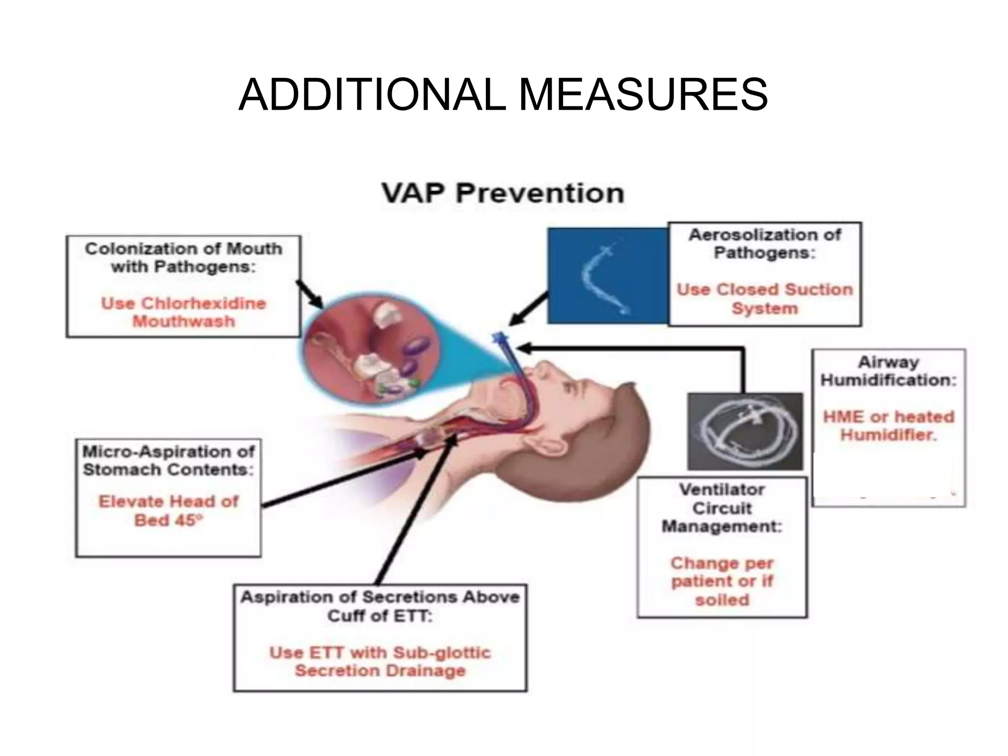Icu care bundles.pptx