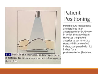ICU CHEST radiology and RADIOGRAPH .pptx