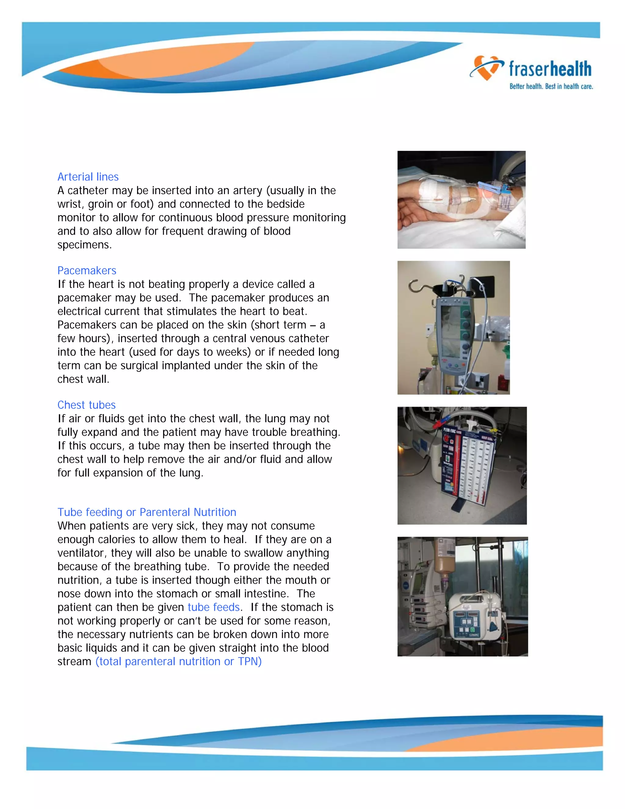 Icu common equipment | PDF